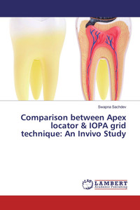 Comparison between Apex locator & IOPA grid technique: An Invivo Study: Buy Comparison between ...