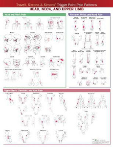 Travell, Simons & Simons' Trigger Point Pain Patterns Wall Chart: Buy Travell, Simons & Simons ...