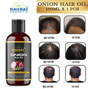nagbai Onion Hair Oil-Hair Growth Oil-Reduces hair fall- With Natural Coconut Oil Hair Oil ...