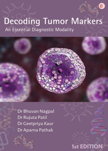 Decoding Tumor Markers An Essential Diagnostic Modality: Buy Decoding Tumor Markers An Essential ...