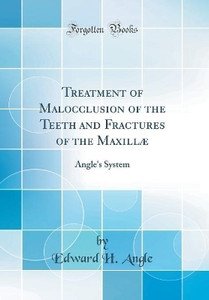Treatment of Malocclusion of the Teeth and Fractures of the Maxillae: Buy Treatment of ...
