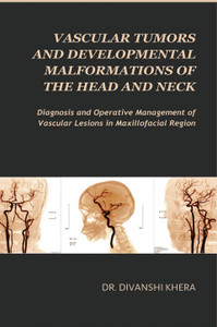 VASCULAR TUMORS AND DEVELOPMENTAL MALFORMATIONS OF THE HEAD AND NECK Diagnosis and Operative ...