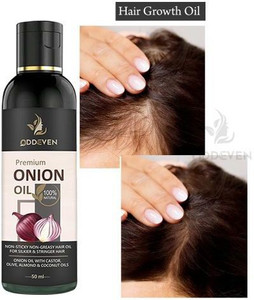 NAINITAL Onion Hair Oil with 14 Essential Oils for Hair Regrowth, Dandruff Control Hair Oil ...