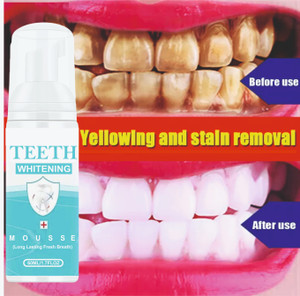 SKOOKUM Teeth Whitening Liquid For Dream White Teeth and Mouth Wash Teeth Whitening Liquid Price ...