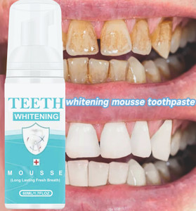 Latibule Dream White -Fresh Mint Instant Teeth Whitening Foam Teeth Whitening Kit Price in India ...