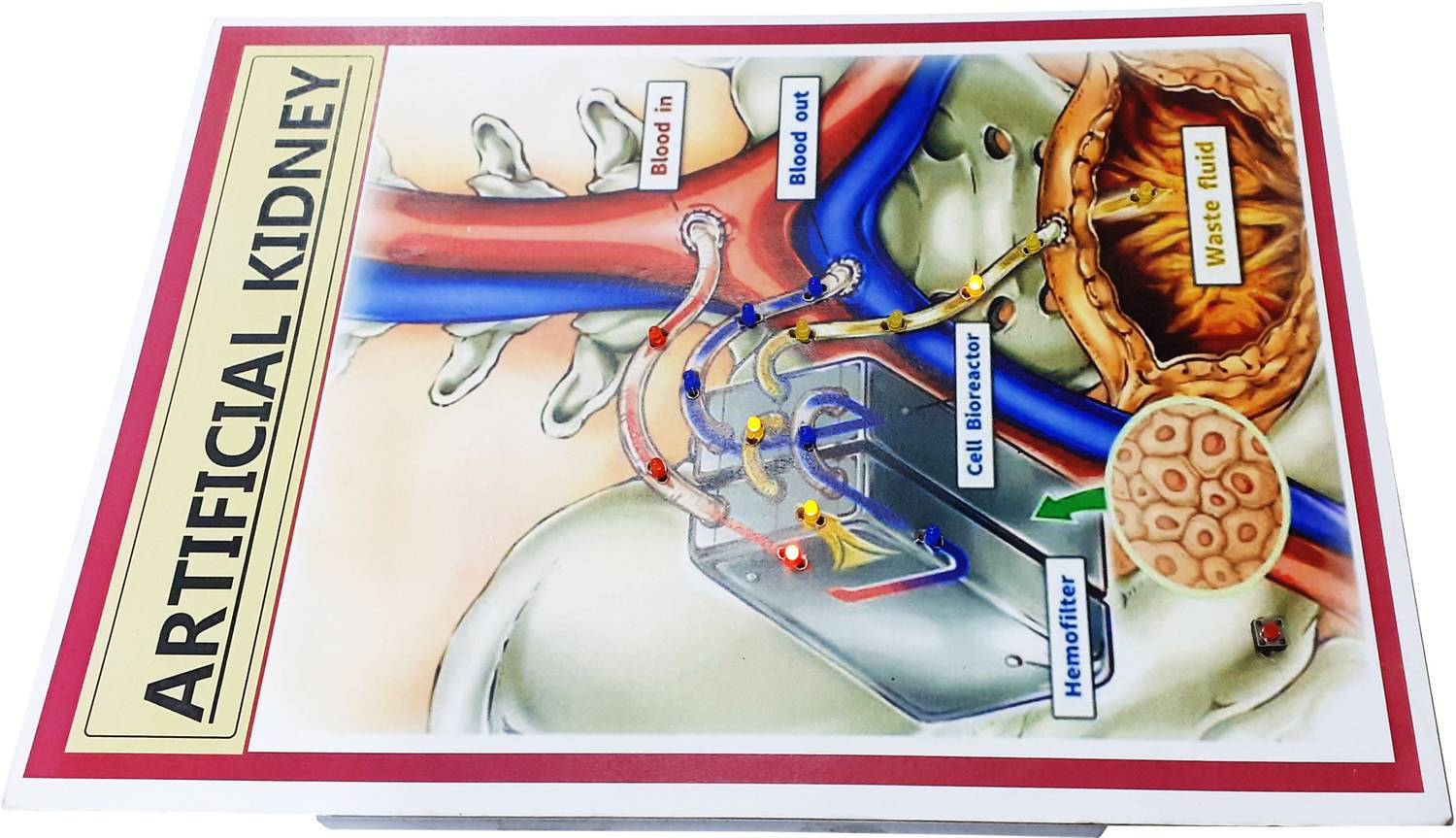 artificial kidney project