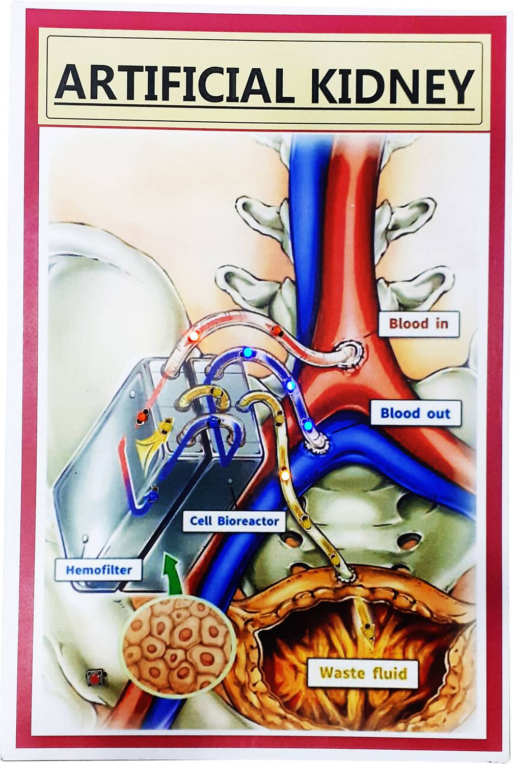 artificial kidney project