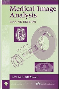 Medical Image Analysis 2nd Edition: Buy Medical Image Analysis 2nd ...