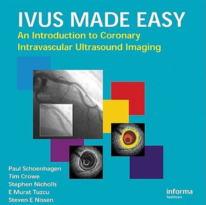 IVUS Made Easy: Buy IVUS Made Easy by Schoenhagen Paul at Low Price in ...