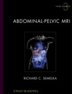 Abdominal-pelvic MRI 3rd Edition: Buy Abdominal-pelvic MRI 3rd Edition ...