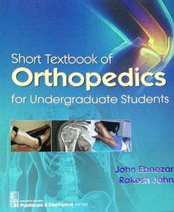 Short Textbook of Orthopedics for Undergraduate Students: Buy Short ...