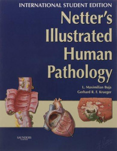 Netter's Illustrated Human Pathology: Buy Netter's Illustrated Human ...