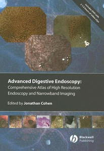 Comprehensive Atlas of High Resolution Endoscopy and Narrowband Imaging ...