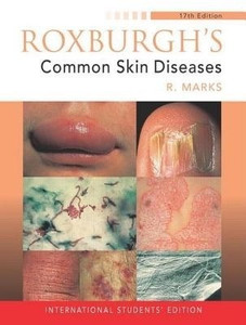 Roxburgh's Common Skin Diseases, 17Ed: Buy Roxburgh's Common Skin ...