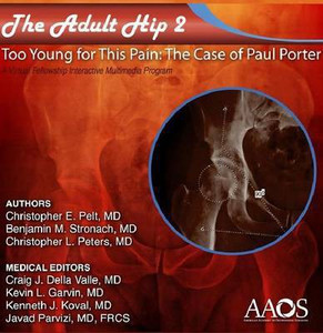 The Adult Hip: Case 2 (Acetabular Dysplasia): Buy The Adult Hip: Case 2 ...
