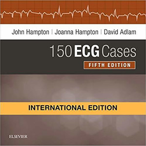 150 ECG Cases, International Edition: Buy 150 ECG Cases, International ...