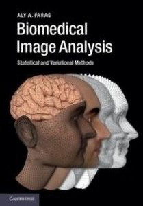 Biomedical Image Analysis: Buy Biomedical Image Analysis by Farag Aly A ...