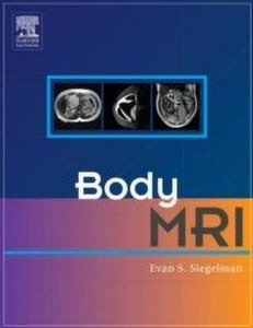 Body MRI: Buy Body MRI by Siegelman Evan S. at Low Price in India ...