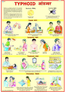 Typhoid Chart Photographic Paper - Educational posters in India - Buy ...