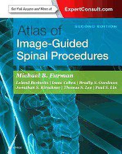 Atlas of Image-Guided Spinal Procedures: Buy Atlas of Image-Guided ...