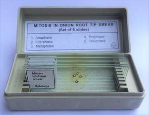 AIM Mitosis Slide Set (Onion Root Tip) Microscope Slide Box Price in ...