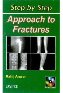 Step By Step Approach To Fractures: Buy Step By Step Approach To ...