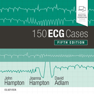 150 ECG Cases: Buy 150 ECG Cases by Hampton John MD, MA, BM, BCh, FRCP ...
