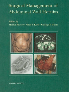 Surgical Management of Abdominal Wall Hernias: Buy Surgical Management ...