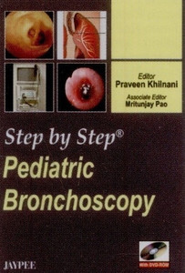 Step by Step: Pediatric Bronchoscopy: Buy Step by Step: Pediatric ...