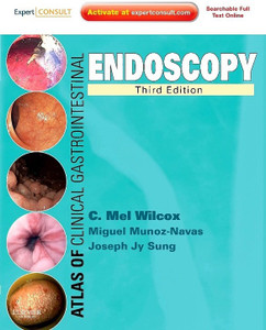 Atlas of Clinical Gastrointestinal Endoscopy: Buy Atlas of Clinical ...