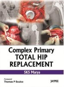 Complex Primary Total Hip Replacement: Buy Complex Primary Total Hip ...