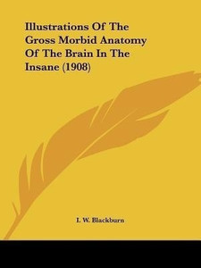 Illustrations Of The Gross Morbid Anatomy Of The Brain In The Insane ...