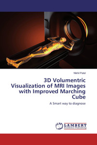 3D Volumentric Visualization of MRI Images with Improved Marching Cube ...