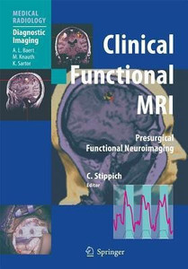 Clinical Functional MRI: Buy Clinical Functional MRI by unknown at Low ...