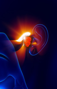 ENT Posters ,Diseases of Ear, Nose and Throat Middle Ear Infections ...