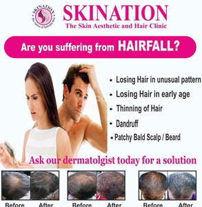 Hair Solution - Falling - Transplant Wall Poster Clinic Poster 12 X 18 ...