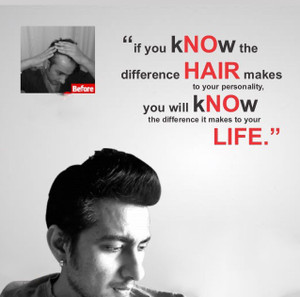 Hair Solution - Falling - Transplant Wall Poster Clinic Poster 12 X 18 ...