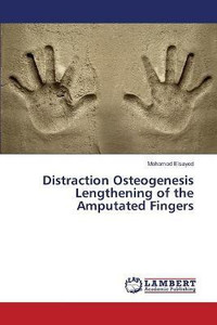 Distraction Osteogenesis Lengthening of the Amputated Fingers: Buy ...