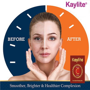 Kaylite Vitamin C Moisturizer Fairness Face Cream 30 Gr (Pack of 1) (30 ...