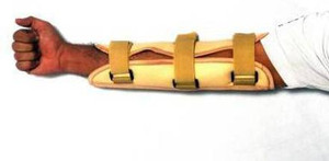 Medisplint Elbow Splint/Brace Immobilizer Elbow Brace - Arm brace ...