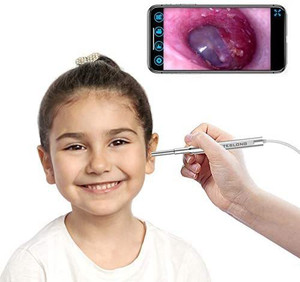 Teslong WiFi Otoscope for iPhone, Ultra-Slim Wireless Ear Scope Camera ...