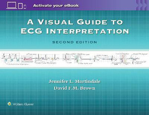 A Visual Guide to ECG Interpretation: Buy A Visual Guide to ECG ...