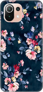 COBIERTAS Back Cover for Mi 11 Lite, Mi 11 Lite NE, Mi 11 Lite 5G ...