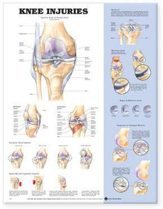 Knee Injuries Anatomical Chart: Buy Knee Injuries Anatomical Chart by ...