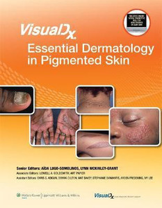 VisualDx: Essential Dermatology in Pigmented Skin: Buy VisualDx ...