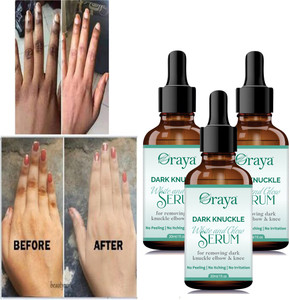 Oraya Neck, Elbow, Back, Hand, Whitening Body Serum For Black-30ML-3 ...