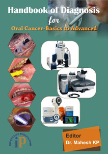 Handbook of Diagnosis for Oral Cancer-Basics to Advanced: Buy Handbook ...