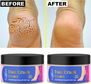 ELIBLISS Foot Crack Cream for Dry Cracked Heels & Feet and Dehydrated ...