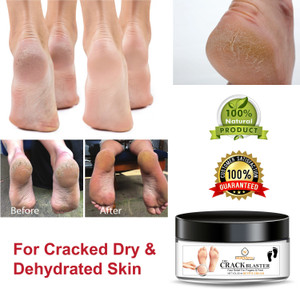 NUATRAFOL Foot Crack Cream For Dry Cracked Heels & Feet 100% Guaranteed ...