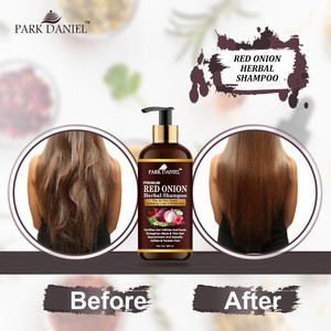 PARK DANIEL Premium Red Onion Herbal Shampoo - For Anti Hair Fall Pack ...
